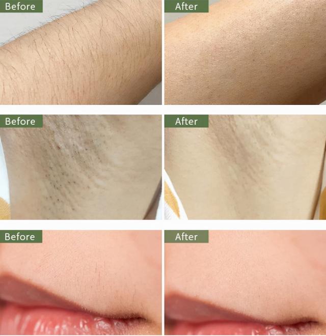 Ulike hair removal device is an artifact that can also become beautiful ...