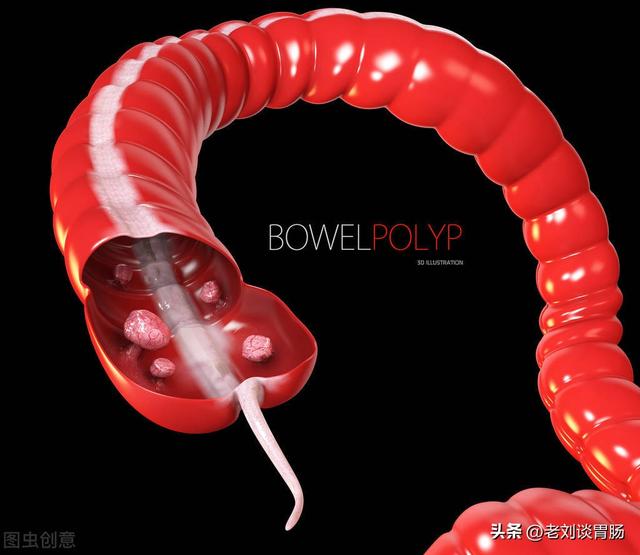 How does the body feel when polyps grow in the intestines? - iMedia