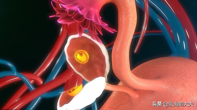 Salpingography cannot be done blindly, so when should it be done? - iMedia