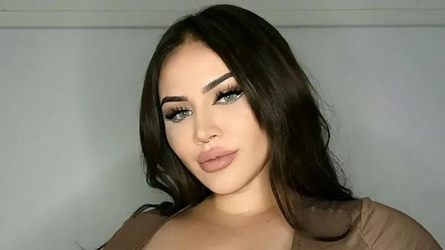 Rare form of macromastia caused Australian woman's bust to balloon by ...