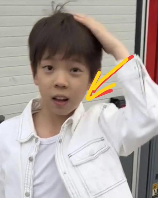 Huo Siyan posted a recent photo of huh, huh, it seems to be an adenoid ...