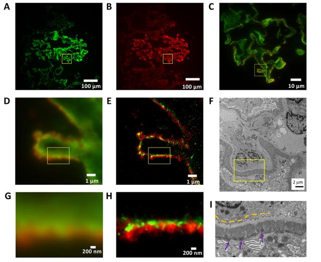 Knowledge Sharing Direct stochastic optical reconstruction microscopy ...