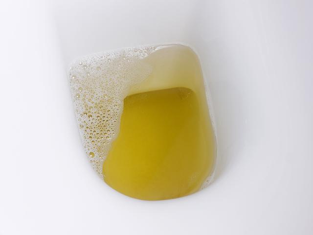 Is foamy urine serious?What exactly is foam in urine? - iMedia