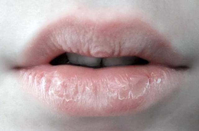Lip peeling and cracking in autumn and winter can be done with these 3 ...