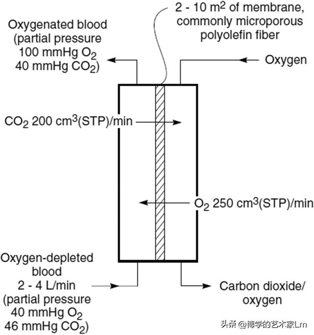 ECMO: Polymer hollow fiber membrane oxygenator as artificial lung - iMedia