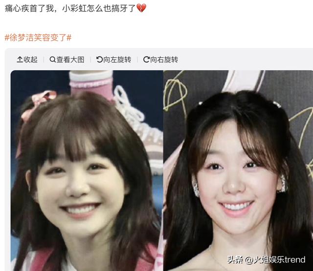 Xu Mengjie denied plastic surgery, and netizens laughed at the fact that Wu Xuanyi introduced ...