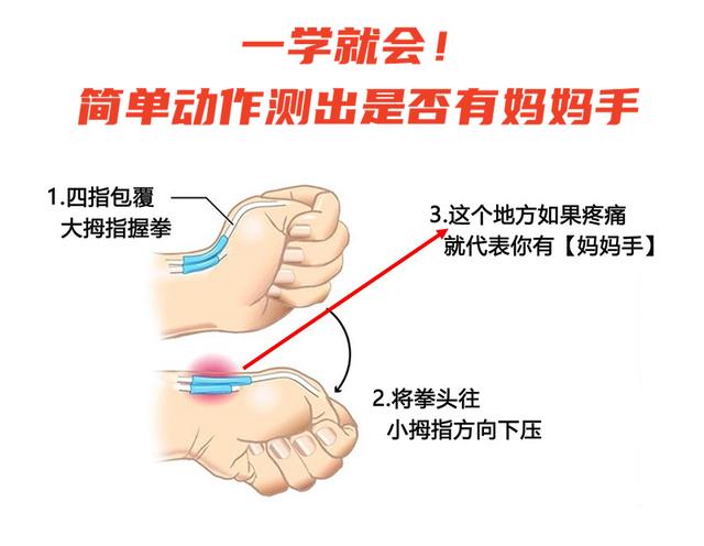 What's with the wrist pain?Is the wrist pain a mother's hand? - iMedia