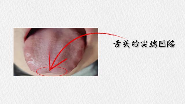 How to make up for qi deficiency?The tongue tells you the answer, and ...