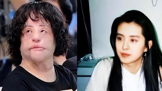Han Huijing, who is "obsessed with plastic surgery", is so crazy that ...