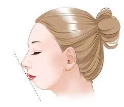 [Orthodontics]A means to improve the shape of the face? - iMedia