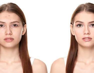 What happens if you don't wash your face for a month?How often do you ...