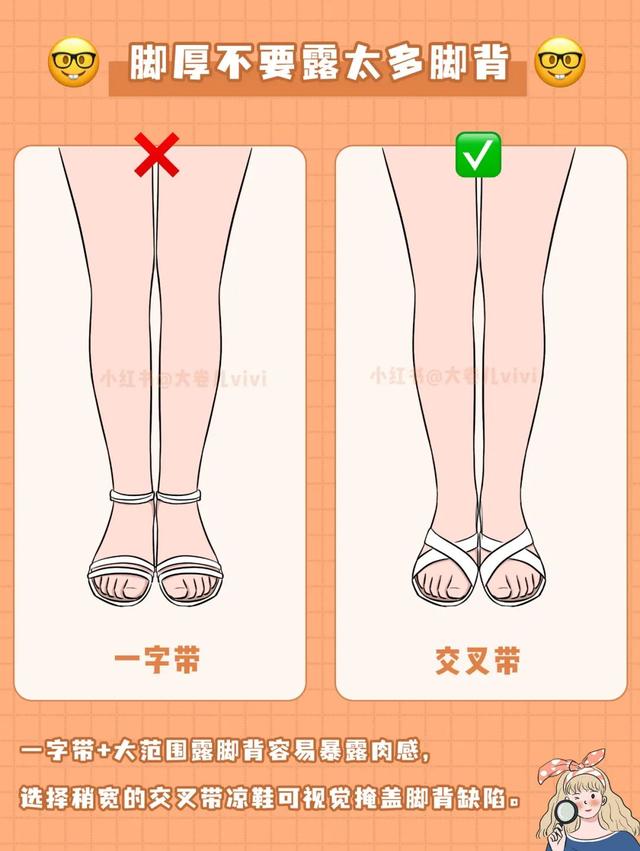 Wide feet and fat ankles, how to choose sandals? - iMedia