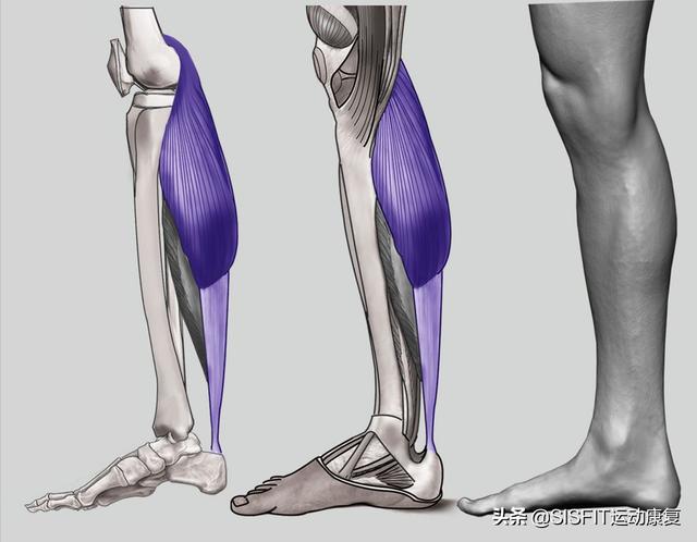 The second human heart, the evaluation and relaxation of the soleus ...