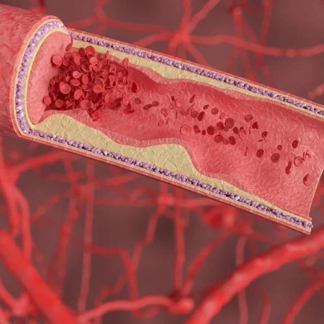 If blood fat does not drop but rises, it may be due to the lack of ...