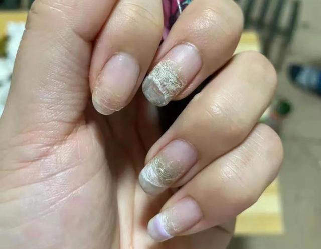 The dangers of long-term nail art, really don't do nails frequently ...