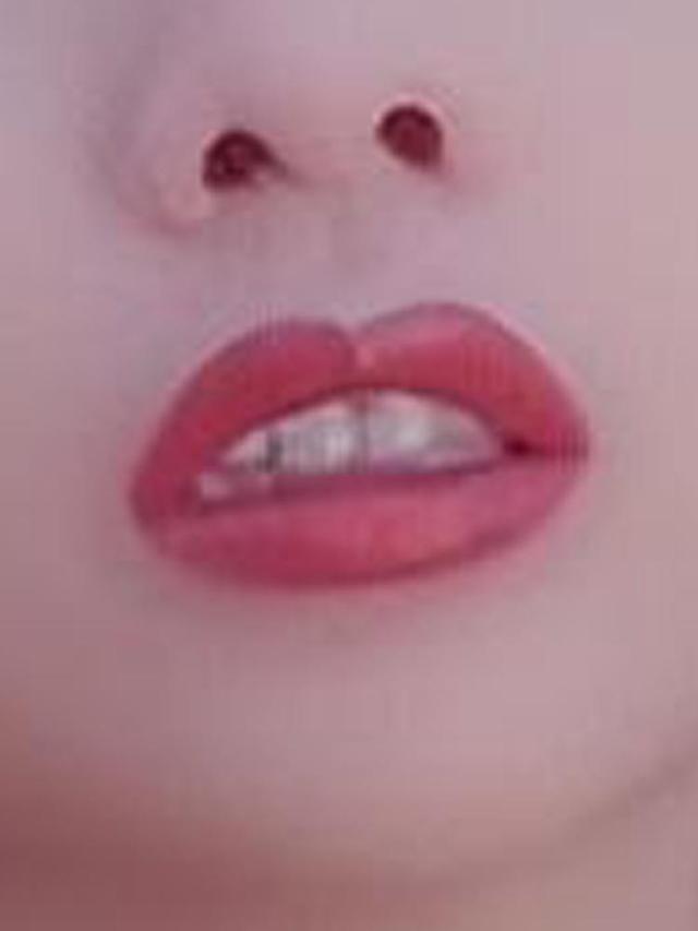 Buck teeth and protruding mouth with exposed gums, why is she sought ...