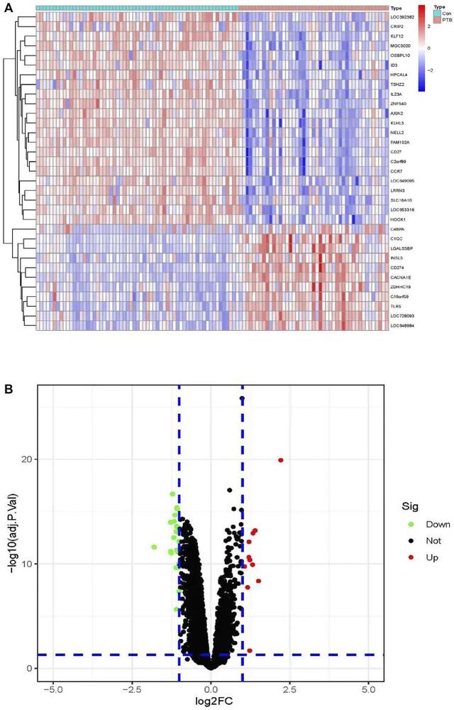 Construction of pulmonary tuberculosis diagnosis model based on random ...