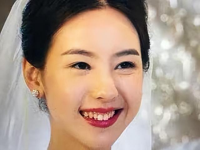 Buck teeth, dentures, large die teeth, these 12 actresses are beautiful ...