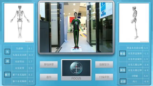 "Anterior Pelvic Tilt" Teenager's Bad Posture Correction Case - iMedia