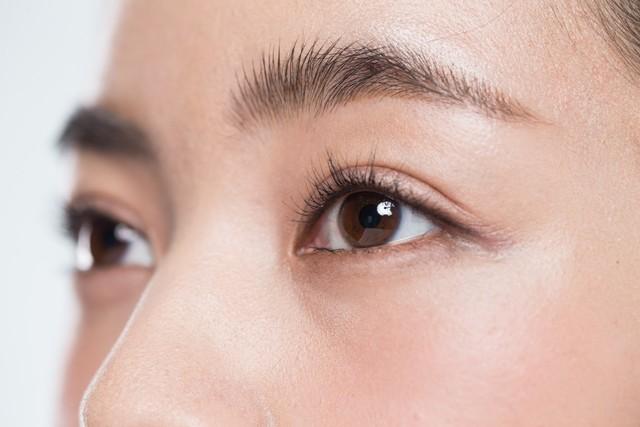 How did the fat particles around the eyes come from? - iMedia