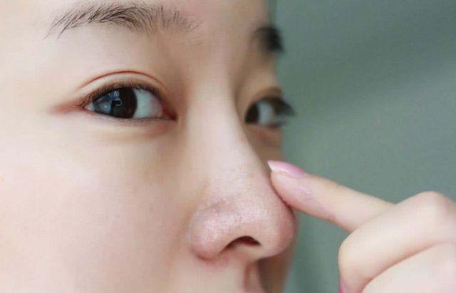 What is the "white thing" squeezed out on both sides of the nose?Is it ...