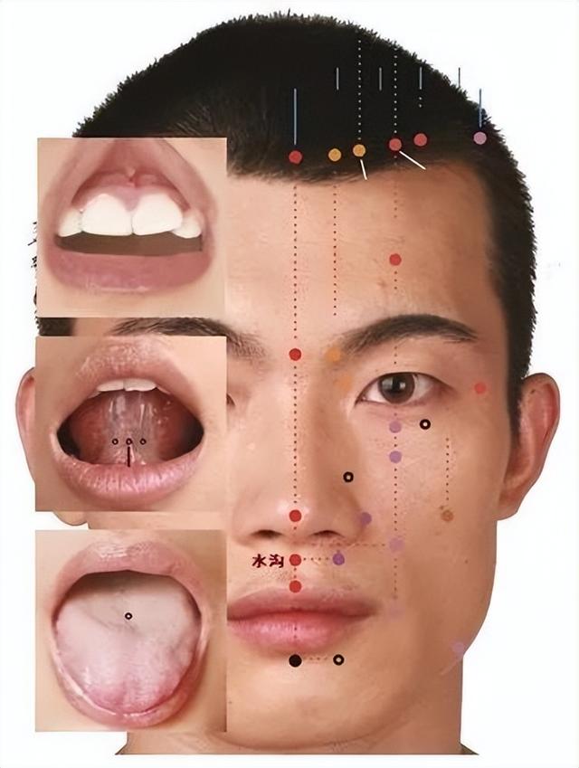 The pain of depression, try to relieve it through these acupuncture ...