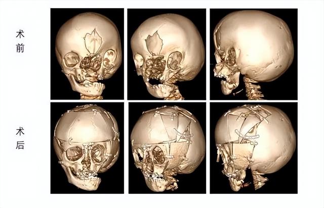A child with severe craniofacial deformity is reborn, and the ...