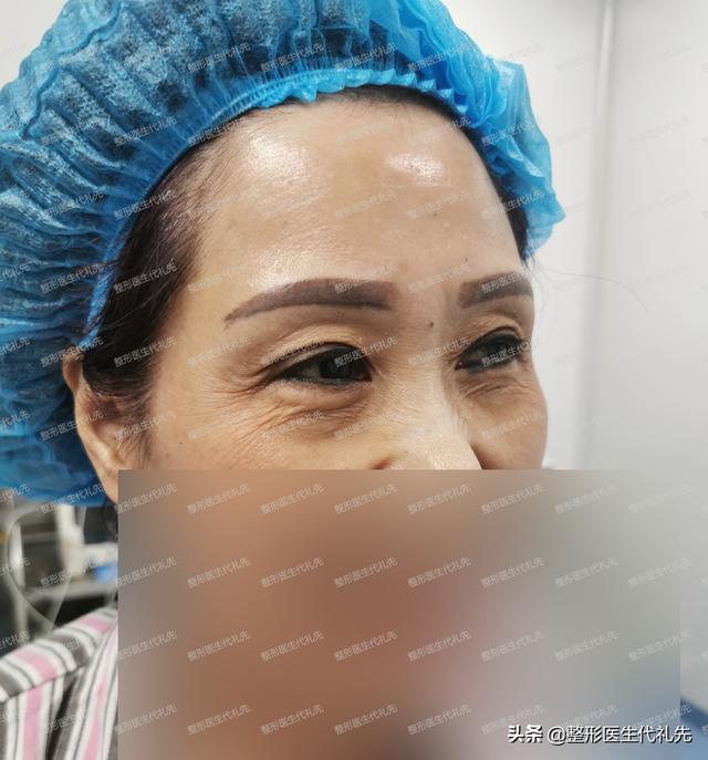 The eye area is firm and does not sag, and you are younger than your ...