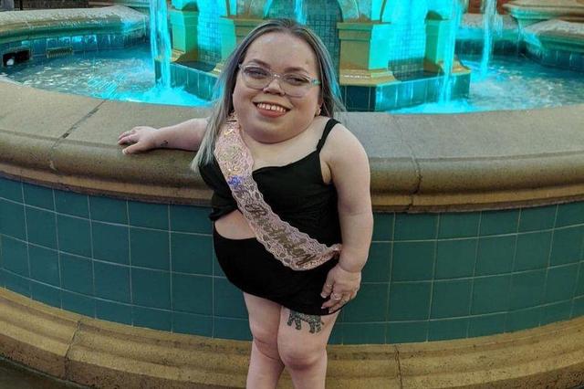 A 25-year-old dwarf woman in the United States is only 0.9 meters tall ...