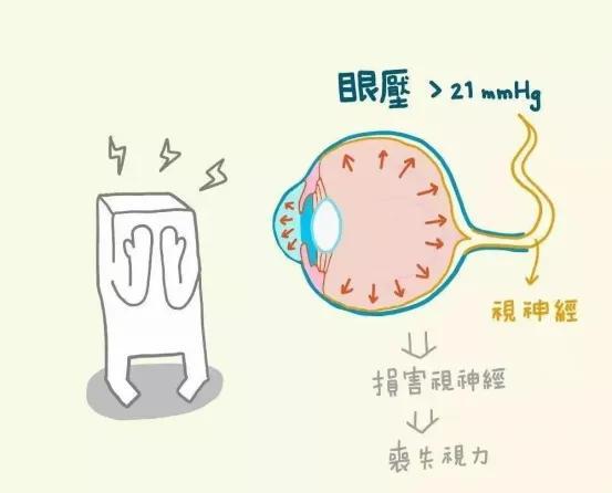 Don't ignore the problem of intraocular pressure if you are nearsighted ...