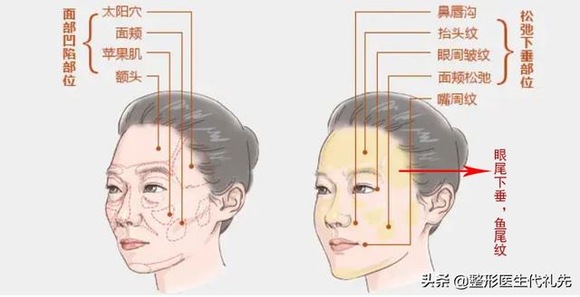 Sunken temples, convex cheekbones, diamond-shaped face, choose a ...