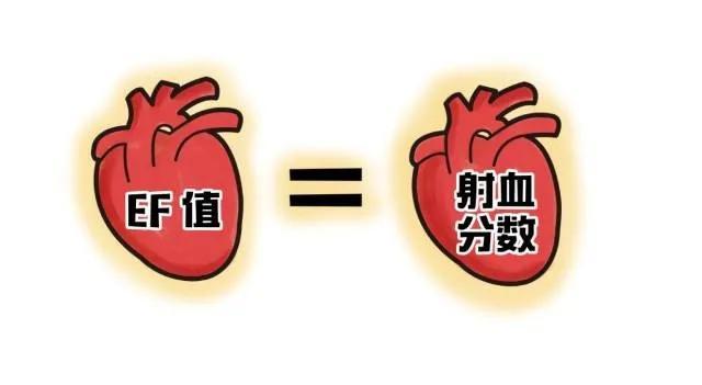 What is the normal cardiac ejection fraction on echocardiography, 45% ...