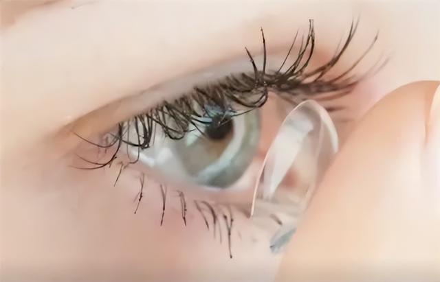 The woman's cornea is full of new blood vessels: wearing contact lenses ...