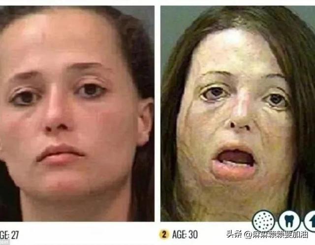 "Dark Glory" This is the real face change before and after taking drugs ...