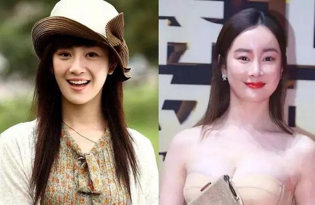 The history of actress plastic surgery blood and tears: Lou Yixiao ...