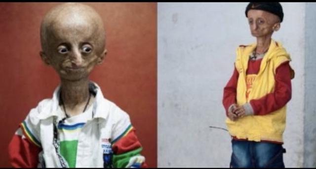 Man Who Looks Like Alien Everyone Cried After He Died - iMedia