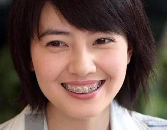 The gap between the front and back of the female star after the teeth ...