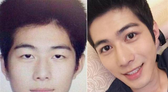 Male star plastic surgery is also crazy!4 male stars "change their ...