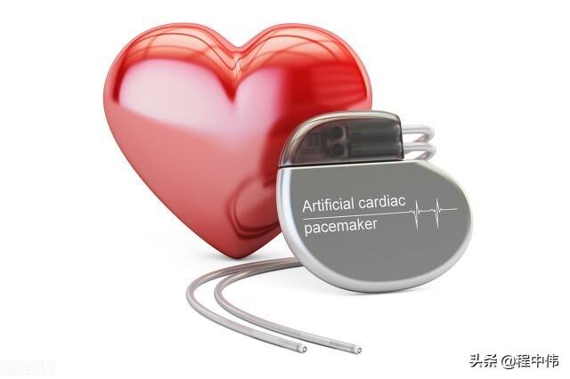 Pacemaker Lead Removal: Requires Great Care - iMedia