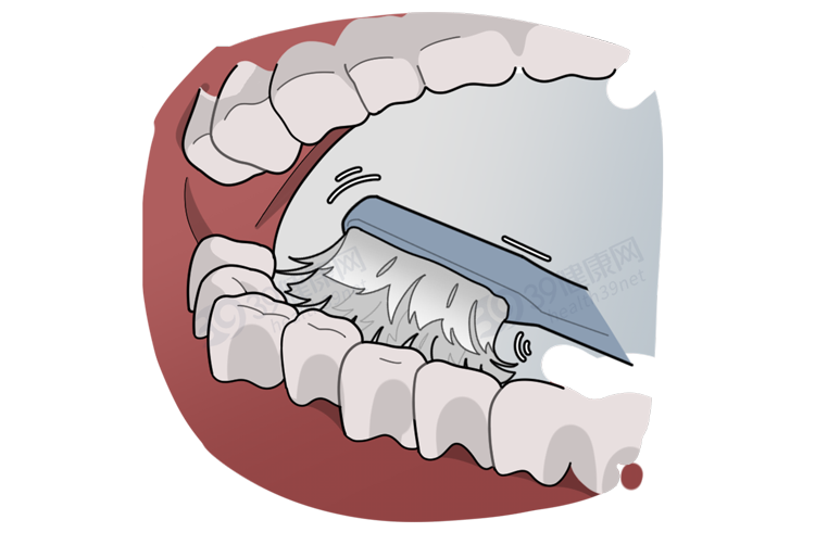 Don't underestimate "sleeping drooling", if it happens frequently ...
