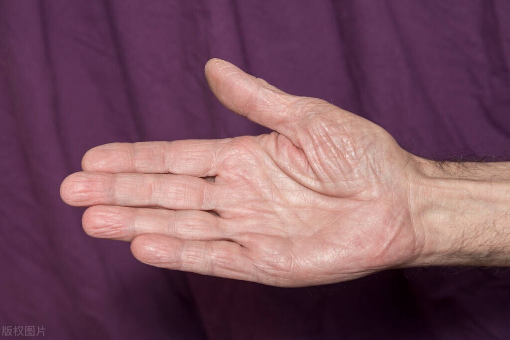 Look at the four reds, know health?The 4 ruddy spots on the body ...