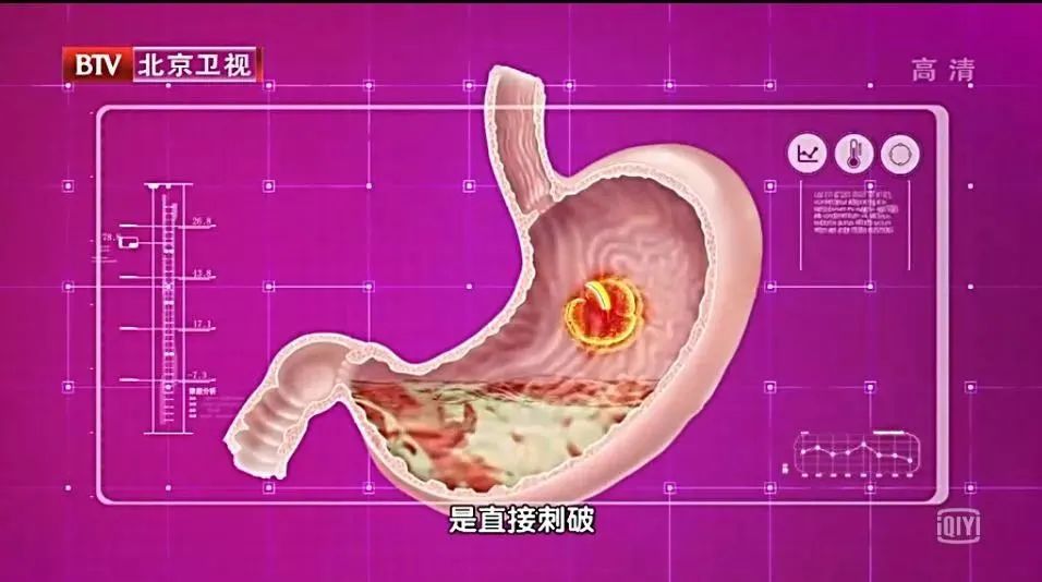 Diseases are mostly self-inflicted?If you don't change these habits ...