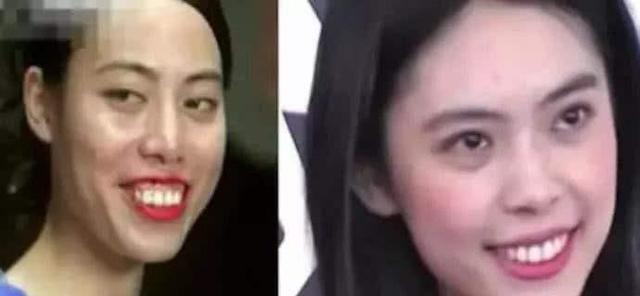 Buck-toothed Zhen in "Kung Fu" is now married, and now her life photos ...